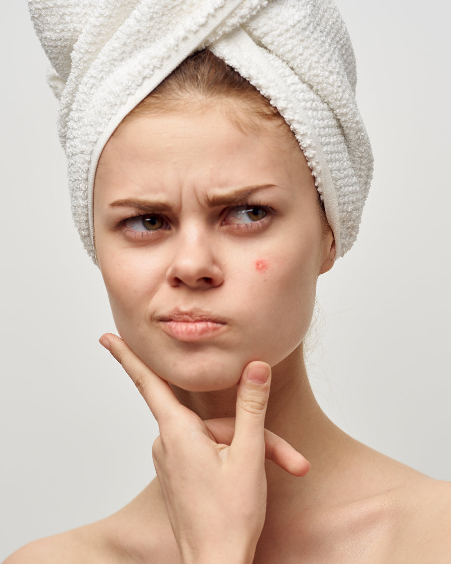 Oily and Acne-Prone Skin – Infinity Clinic Pharma